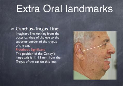 test 1 lecture 6 and alignment occlusion flashcards quizlet