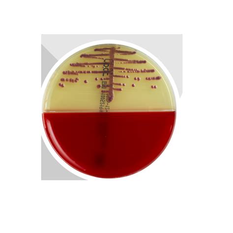 Biomerieux Chromid Cps Elite Columbia Cna 5 Sheep Blood सांस्कृतिक