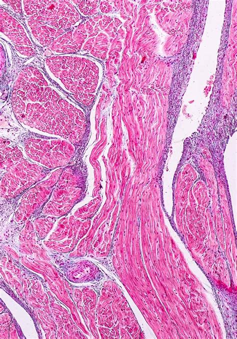 Interventricular Septum And Sulcus