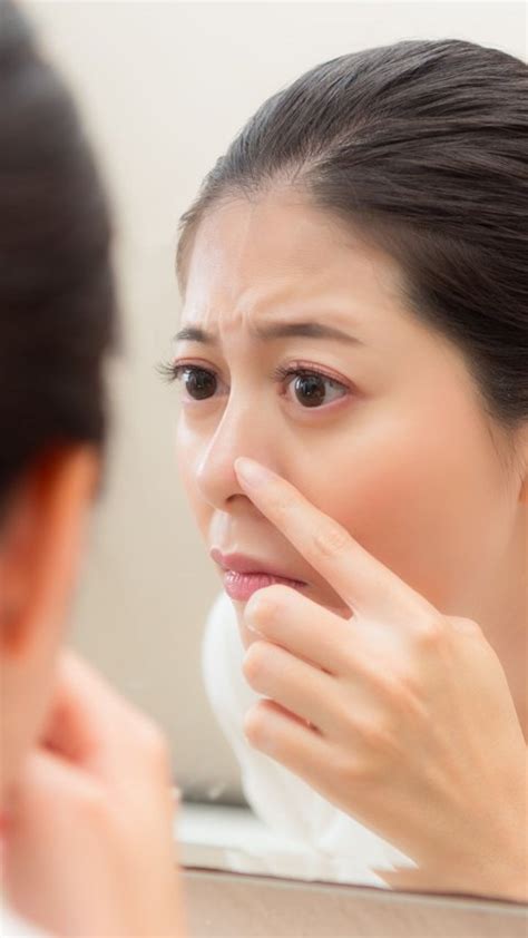 Berita Dan Informasi Komedo Di Hidung Terkini Dan Terbaru Hari Ini Id