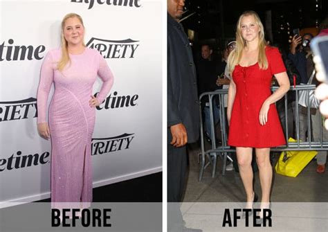 Amy Schumer Is Photographed In Nyc After 30 Lb Weight Loss As Divorce