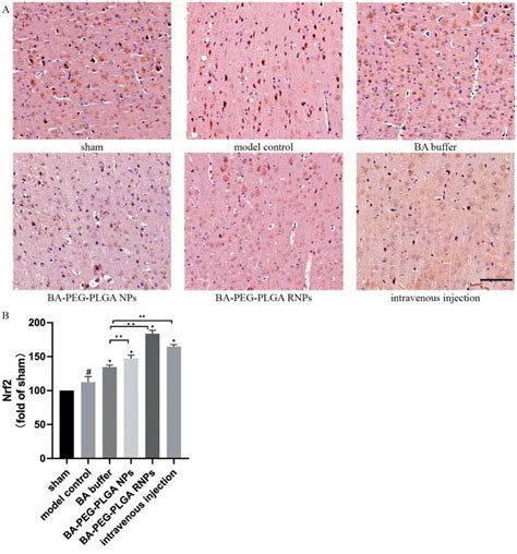 Nrf2 Immunoreactivity In Rat Brain Tissue Immunohistochemistry Light