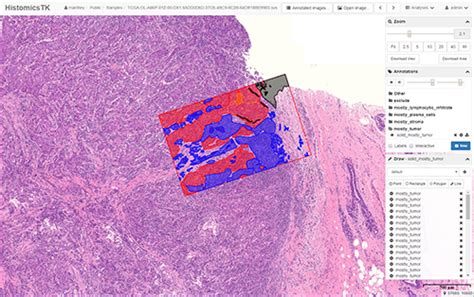 Histomicstk Manage Analyze And Visualize Your Digital Pathology Data