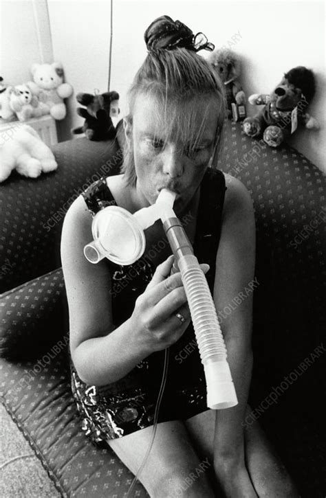 Pneumonia Aids Patient Using Pentamidine Inhaler Stock Image M112 0229 Science Photo Library