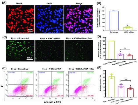 Modulation Of Dex Neuroprotection In Cultured Hippocampal Neurons By