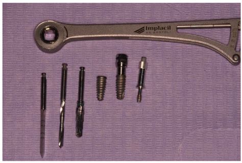 Prosthesis Special Issue Osseointegration Of Oral Implants