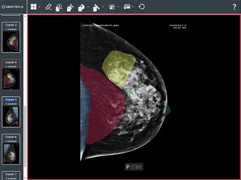 Инновации в медицине внедрение новых технологий список последних цифровых инноваций Sbermed Ai