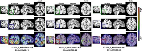 Figure 4 From Brain Status Transferring Generative Adversarial Network For Decoding