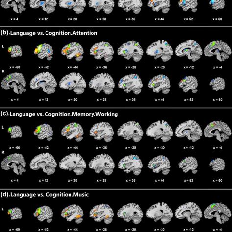Results Of Contrast And Conjunction Analyses On Experiments Categorized