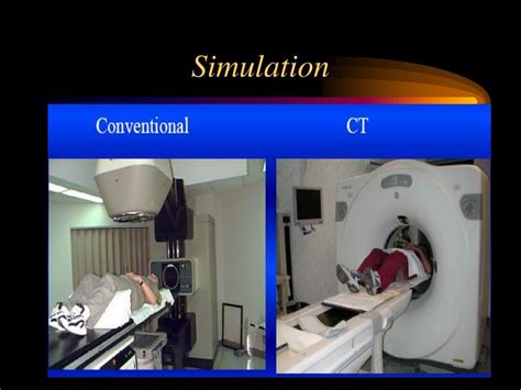 Ppt Radiation Oncology Powerpoint Presentation Free Download Id1414355
