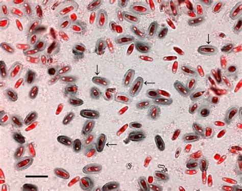 Capsules Of The Diatom Achnanthidium Minutissimum Arise From