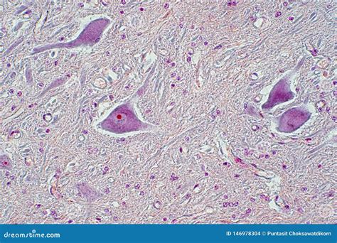 Spinal Cord Cross Section Diagram Spinal Cord Cross