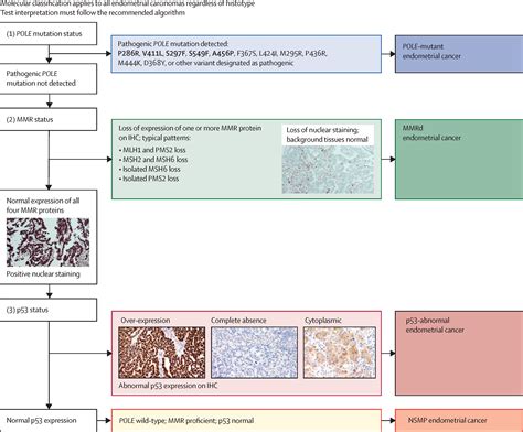 Endometrial Cancer The Lancet