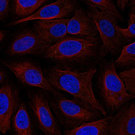 Subcellular Thbs4 The Human Protein Atlas