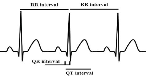 The QT Interval Compared To The RR Interval In A Continuous CG Recording Download Scientific