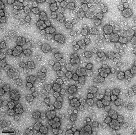 Transmission Electron Microscopy Tem Image Of Pg Scale Bar Download Scientific Diagram