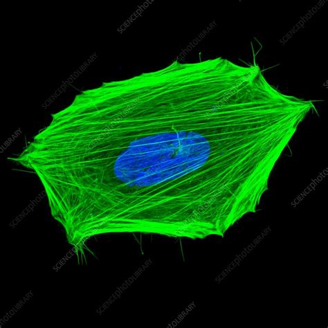 Single Cancer Cell Light Micrograph Stock Image C0489524