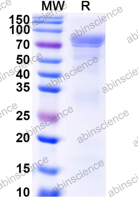 Recombinant Rat Cd71tfrc Protein N Hisdatasheet