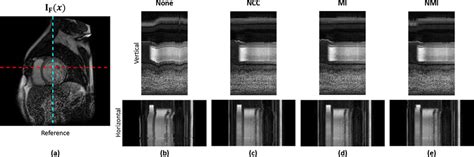 Visual Results For 2d Sequential Elastic Pairwise Pw Registration Of