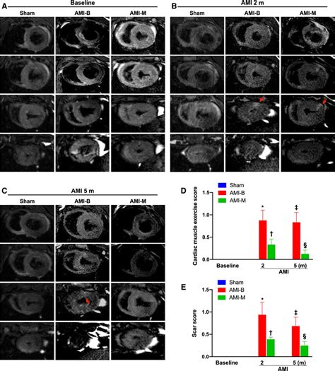 Time Courses Of Cardiac Mri Evaluations For Identification Of Abnormal