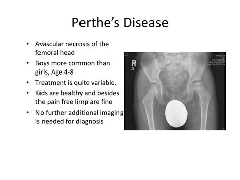 Ppt Gait Abnormalities In Pediatric Orthopedics Powerpoint