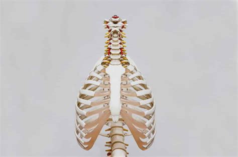 Retro Odontoid Pseudotumor With Cervical Medullary Compression A Case Report Published In