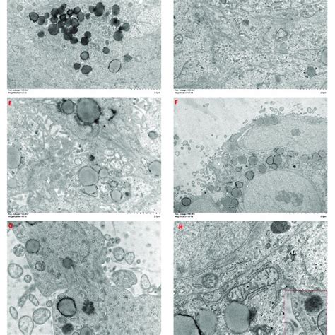 Morphology Of A549 Cells Spheroids Spheroids Were Constructed And