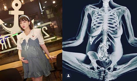 懷孕女藝人po出x光照！懷孕可拍x光？婦產科醫師親自解答！ 嬰兒與母親