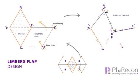 Limberg Rhombic Flap