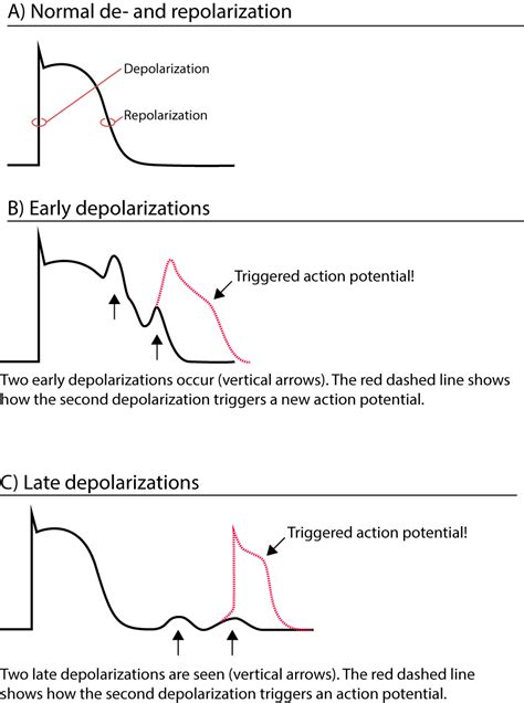 Arrhythmia Causes Lilypure