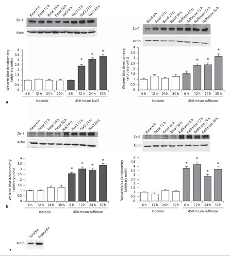 Hyperosmolality And Or Hypernatremia Semantic Scholar