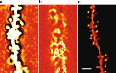 Results Of The Deconvolution A The Deconvolution Algorithms Download Scientific Diagram