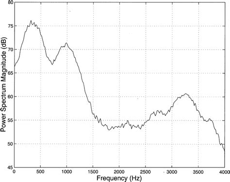 Spectrum Of Speech Shaped Noise Used In This Study Download Scientific Diagram