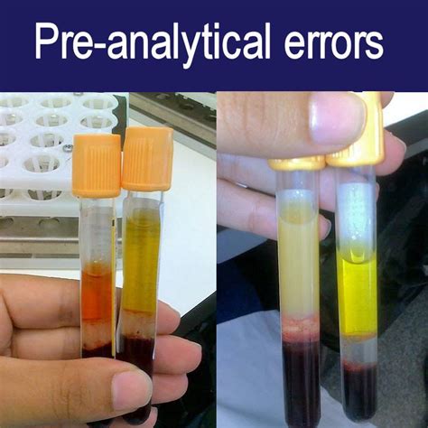 Laboratory Pre Analytical Process At Lois Robinette Blog