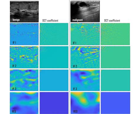 Decomposed Images With Respective Dct Coefficients 2nd And 4th Column