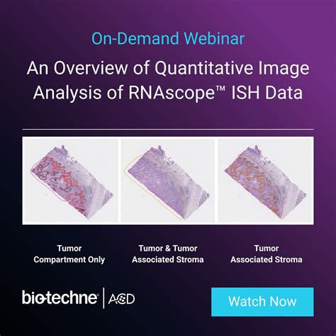 Advanced Cell Diagnostics On Linkedin Species Specific Gene Expression Profiling Of Patient