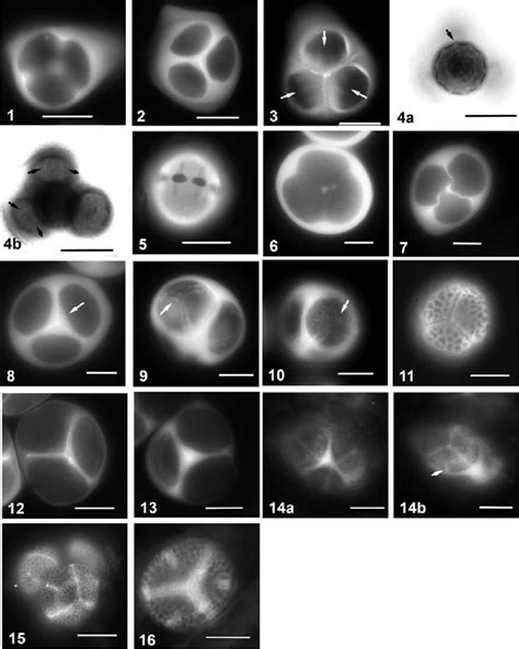 Microsporogenesis 1 5 Symphytum Officinale 1 Simultaneous Download Scientific Diagram