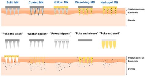 The Necessity To Investigate In Vivo Fate Of Nanoparticle Loaded Dissolving Microneedles Pmc