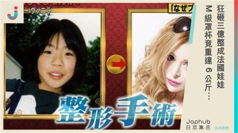 狂砸三億整成法國娃娃！m級罩杯竟重達6公斤⋯ Japhub － 日本集合