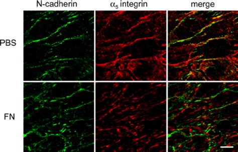 Fibronectin Disrupts ␣ 5 ␤ 1 Integrinn Cadherin Co Localiza Tion Download Scientific Diagram