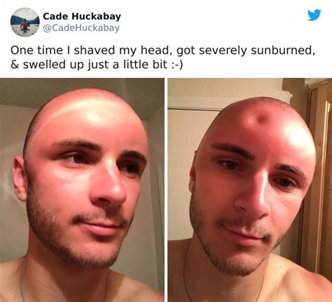 30 People Who Realized The Importance Of Sunscreen The Hard Way Demilked