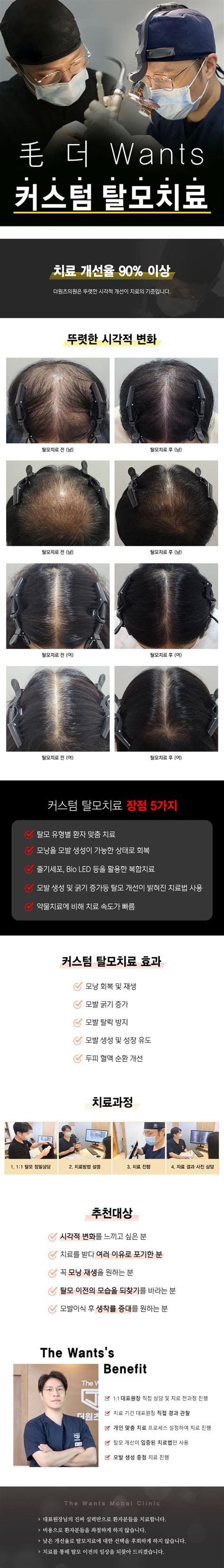 모발이식은 더원츠의원 탈모치료