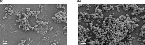 A Combination Aldehyde Fixative Solution Is Superior To Glutaraldehyde