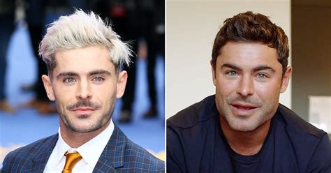 Did Zac Efron Get A Plastic Surgery For His Jaw Before After Look Otakukart