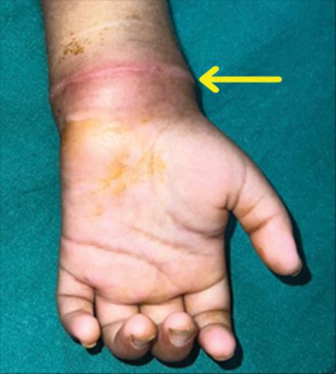 Case Reports In Clinical Radiology Current Issue