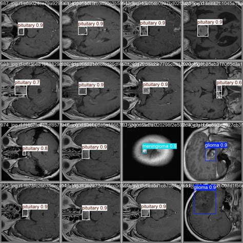 毕业设计 基于yolov11的医学影像脑瘤检测识别系统计算机毕业设计肿瘤诊断系统 Csdn博客