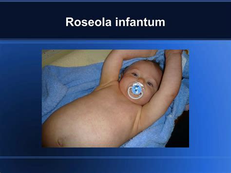 Rash Differential Diagnosis Of Infectious Diseases Ppt