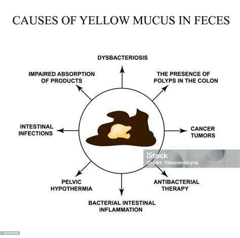 Mucus In Stool Human