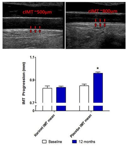 Vladmodels Vika Torrent Lasopapac
