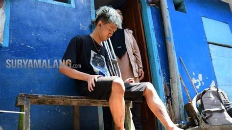 bagas satria aremania korban tragedi kanjuruhan malang kini masih